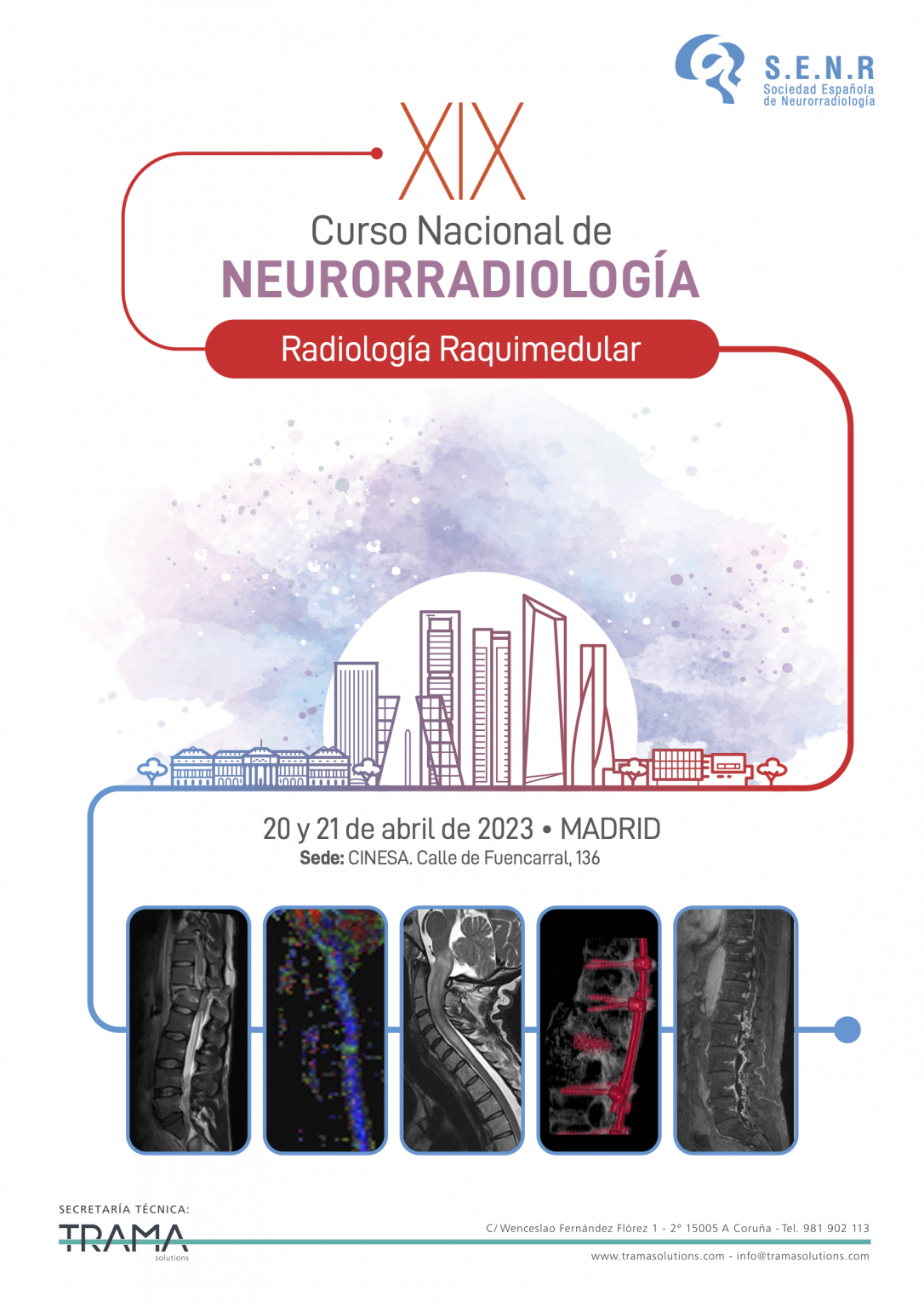 Xix Curso Nacional De Neurorradiología Senr Bienvenid Al Portal De