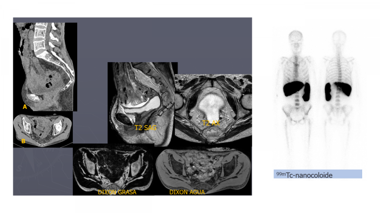 Caso del mes diciembre 2023 – SENR: Bienvenid@ al portal de la SENR ...