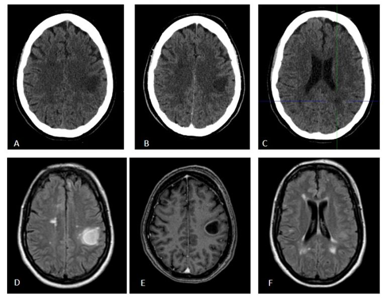 Caso del mes Mayo 2024 - SENR: Bienvenid@ al portal de la SENR ...